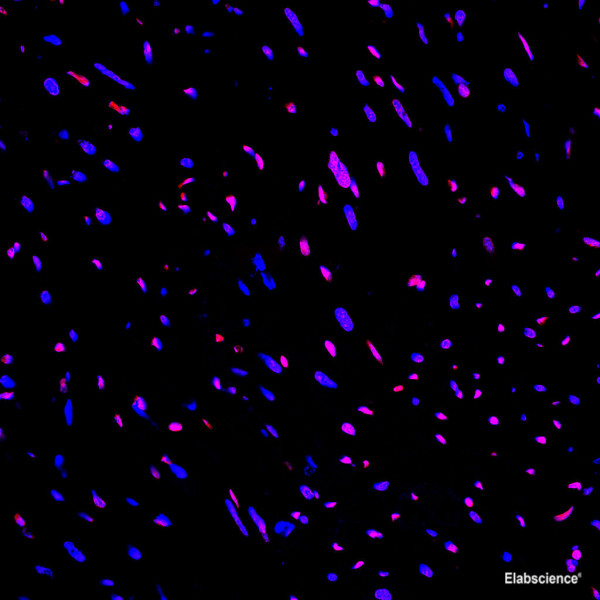 One-step TUNEL in situ Apoptosis Kit (Red, AF594) | Elabscience ...
