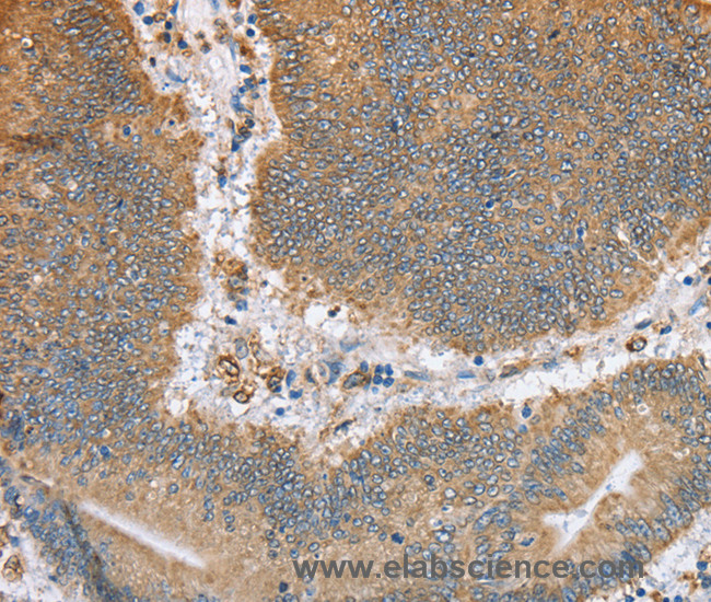 Anti-CANX | Elabscience | Biomol.com