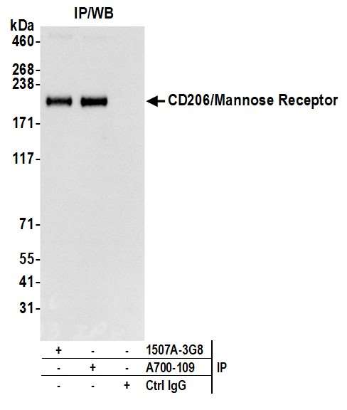 Anti-CD206/Mannose Receptor Recombinant Monoclonal | Bethyl ...