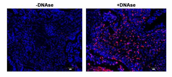 Cell Meter(TM) Fixed Cell and Tissue TUNEL Apoptosis Assay Kit *Deep Red Fluorescence* | AAT ...