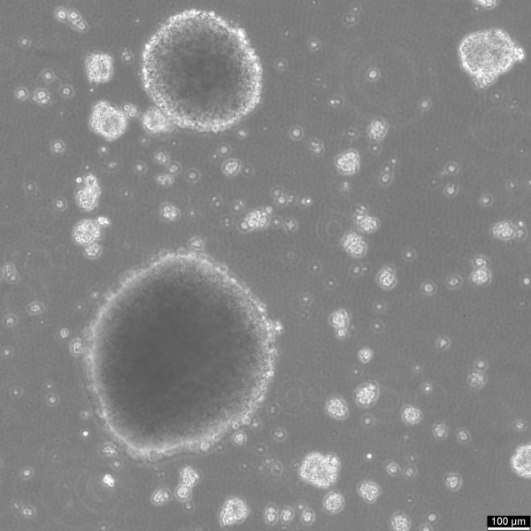 B-LCL-HROC112 Cells | Cytion | Biomol.com