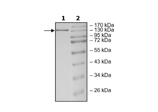 Cas13b, His-Tag (Prevotella sp) Recombinant | BPS Bioscience | Biomol.com