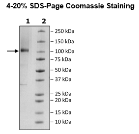 PSMA, His-Avi-Tag, Biotin-Labeled | BPS Bioscience | Biomol.com