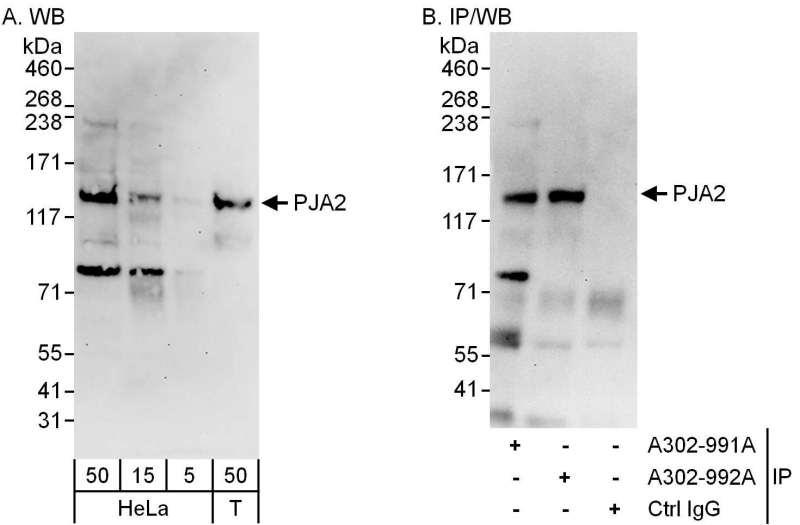 Anti-PJA2 | Bethyl Laboratories | Biomol.com