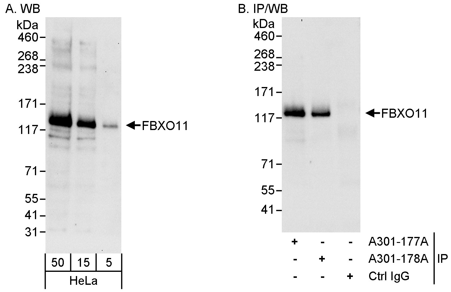 Anti-FBXO11 | Bethyl Laboratories | Biomol.com