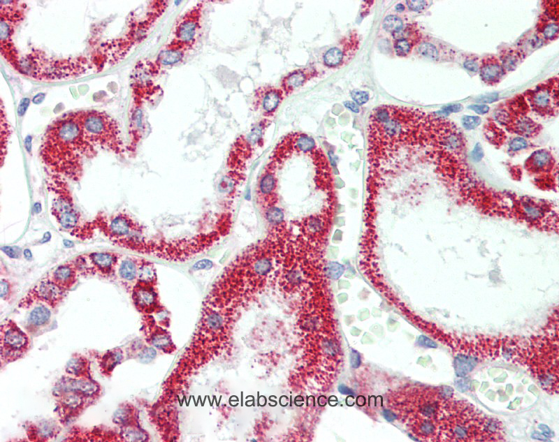 Anti-HSD17B8 | Elabscience | Biomol.com