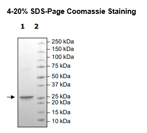 KRAS (G12R), His-Tag | BPS Bioscience | Biomol.com