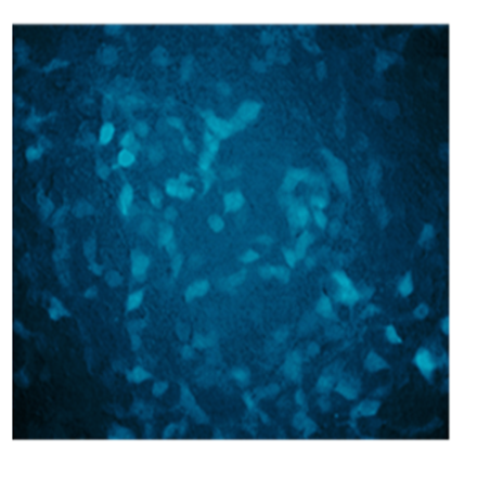 CFP (mTurquoise2) Lentivirus | BPS Bioscience | Biomol.com