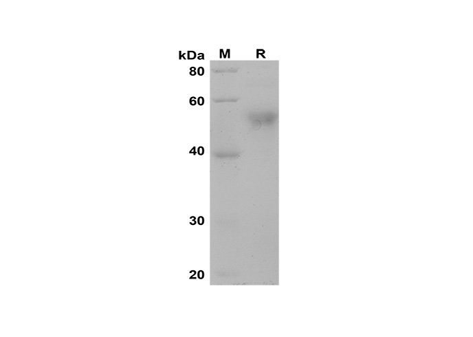 MAP2 (human), recombinant protein (Trx Tag) | Elabscience | Biomol.com