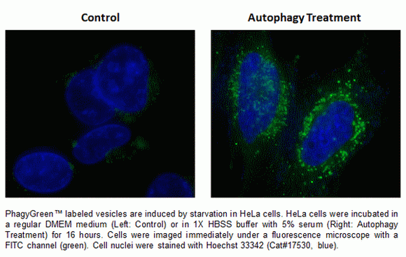 Cell Meter(TM) Autophagy Assay Kit *Green Fluorescence* | AAT Bioquest ...