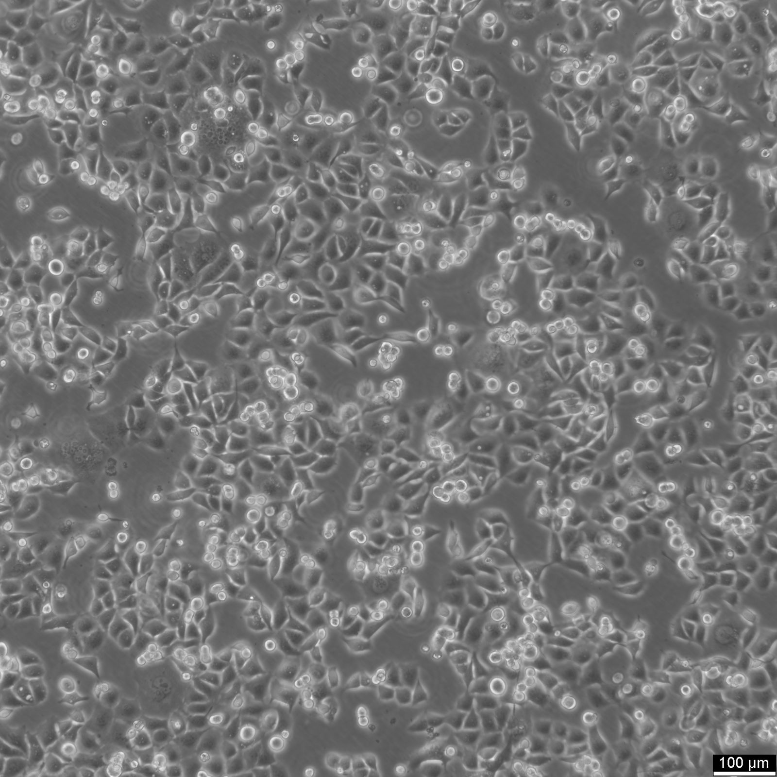 KYSE-30 Cells | Cytion | Biomol.com