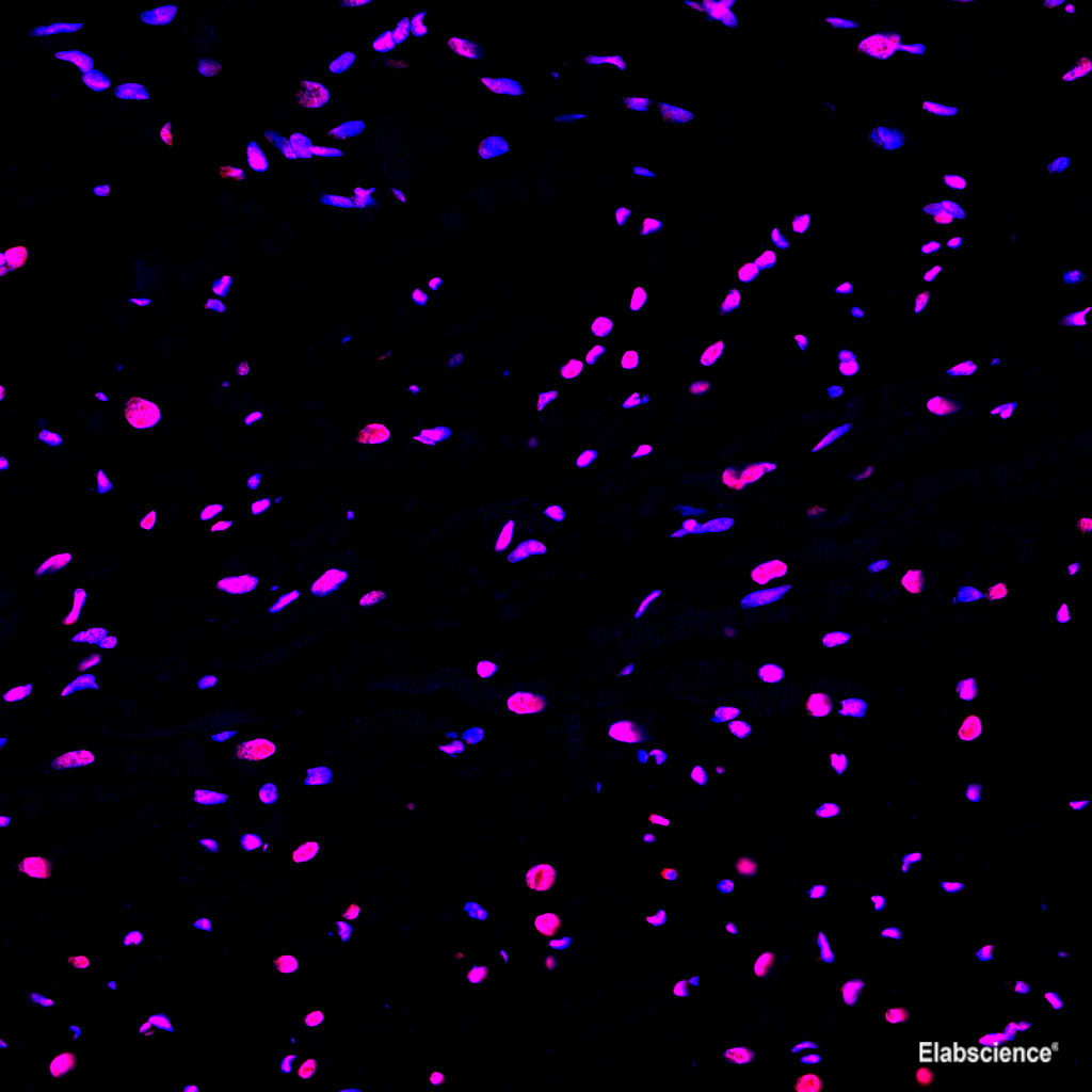One-step TUNEL in situ Apoptosis Kit (Red, AF647) | Elabscience ...