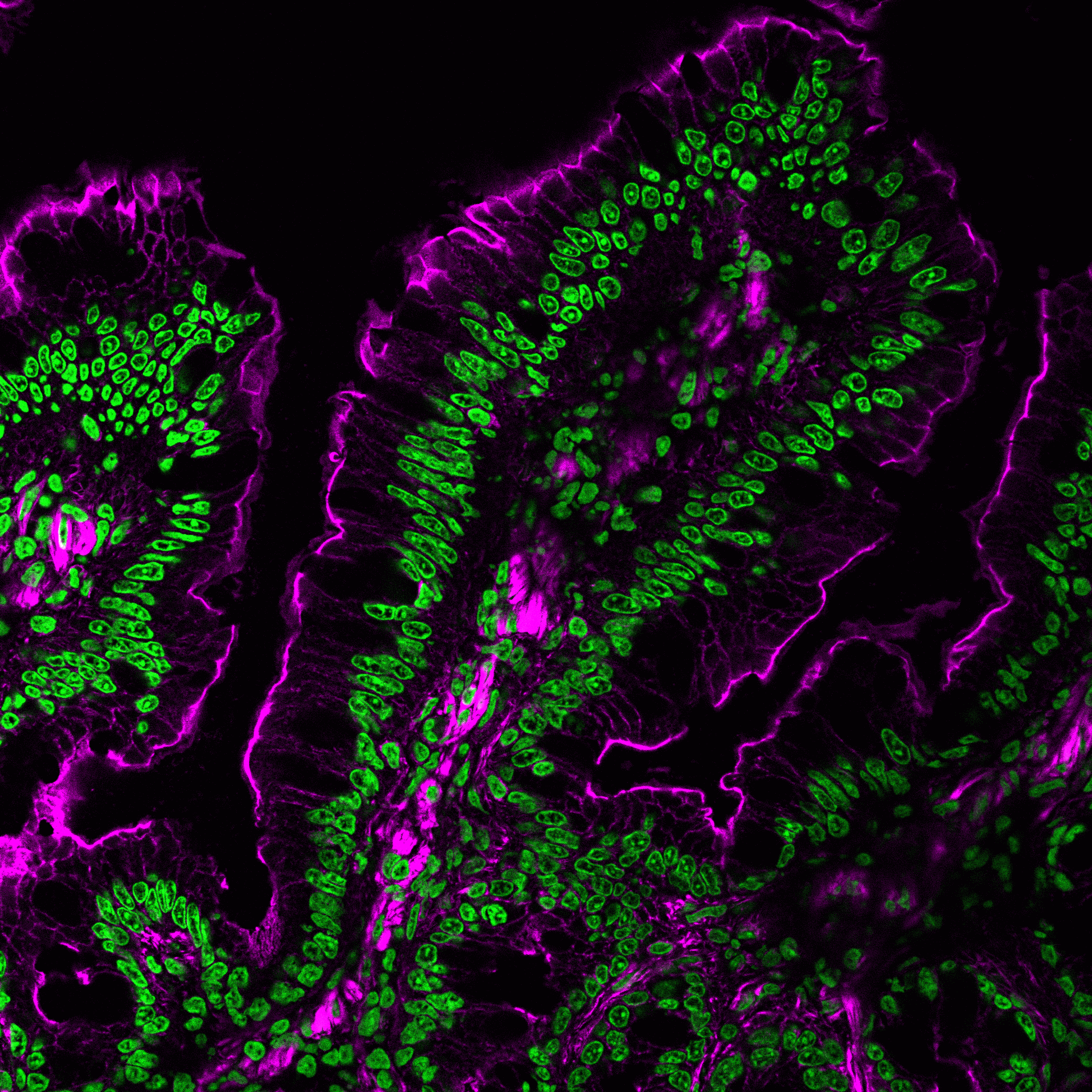 Sulforhodamine 101 (Texas Red(R)) Phalloidin | Biotium | Biomol.de