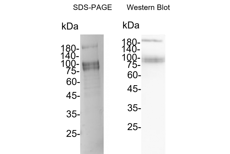 SARS-CoV-2 Trimeric Spike Protein (Beta B1.351 Variant), His Tag ...