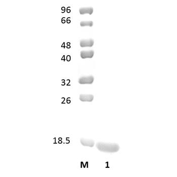 Carbohydrate Binding Module 6F, Clostridium thermocellum | NZYtech ...