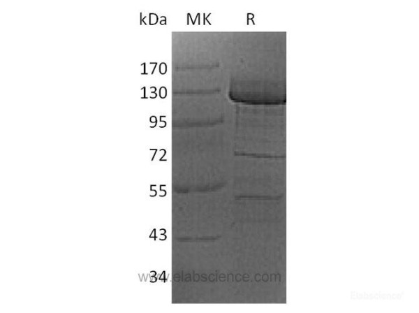 Protocadherin-10/PCDH10 Protein(C-Fc) (recombinant human) | Elabscience ...