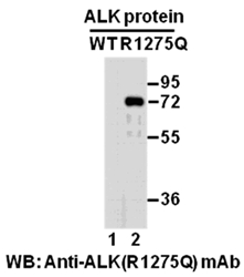 Anti-ALK (R1275Q), monoclonal | NewEast Biosciences | Biomol.com