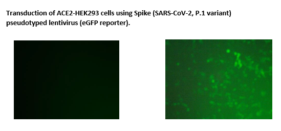 Spike (gamma P.1 Variant) (SARS-CoV-2) Pseudotyped Lentivirus (eGFP Reporter) | BPS Bioscience ...