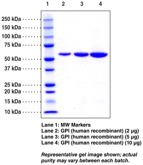 Glucose-6-phosphate Isomerase (human, recombinant) | Cayman Chemical ...