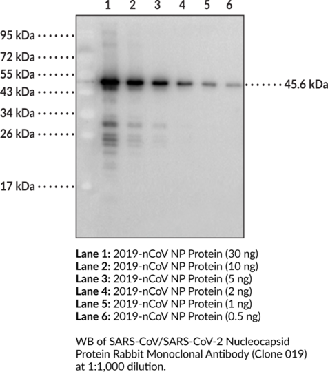 Anti-SARS-CoV/SARS-CoV-2 Nucleocapsid Protein [Rabbit] (Clone 019 ...