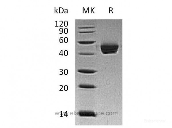 Dipeptidyl-Peptidase 1/DPP1 Protein(C-6His) (recombinant human ...