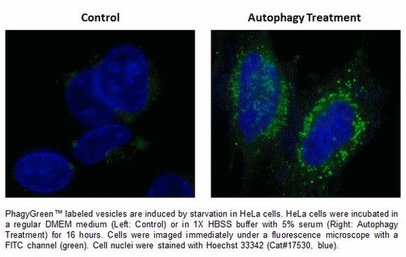 Cell Meter(TM) Autophagy Assay Kit *Green Fluorescence* | AAT Bioquest ...