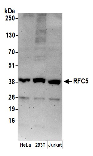 Anti-RFC5 | Bethyl Laboratories | Biomol.com