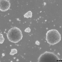 B-LCL-HROC112 Cells | Cytion | Biomol.com