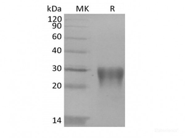 Transforming Growth Factor Beta-1/TGFB1 (recombinant human) | Elabscience | Biomol.de