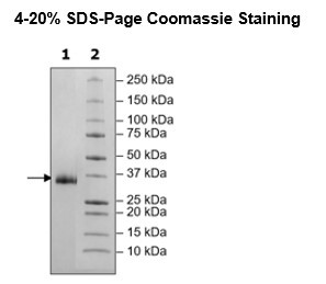 Spike S1 RBD (B.1.617.2, Delta Variant), Avi-His-Tag, Biotin-Labeled (SARS-CoV-2) HiP(TM) | BPS ...
