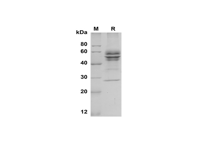 IGFBP6 (human), recombinant protein (hIgG1 Fc Tag) | Elabscience ...