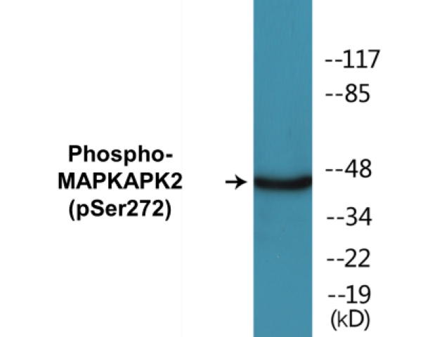 MAPKAPK2 (Phospho-Ser272) Colorimetric Cell-Based ELISA Kit | Assay ...