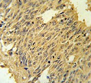 Anti-Mitoferrin-2 / MFRN2 / SLC25A28 | NSJ Bioreagents | Biomol.com