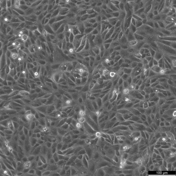 SNU-449 Cells | Cytion | Biomol.com