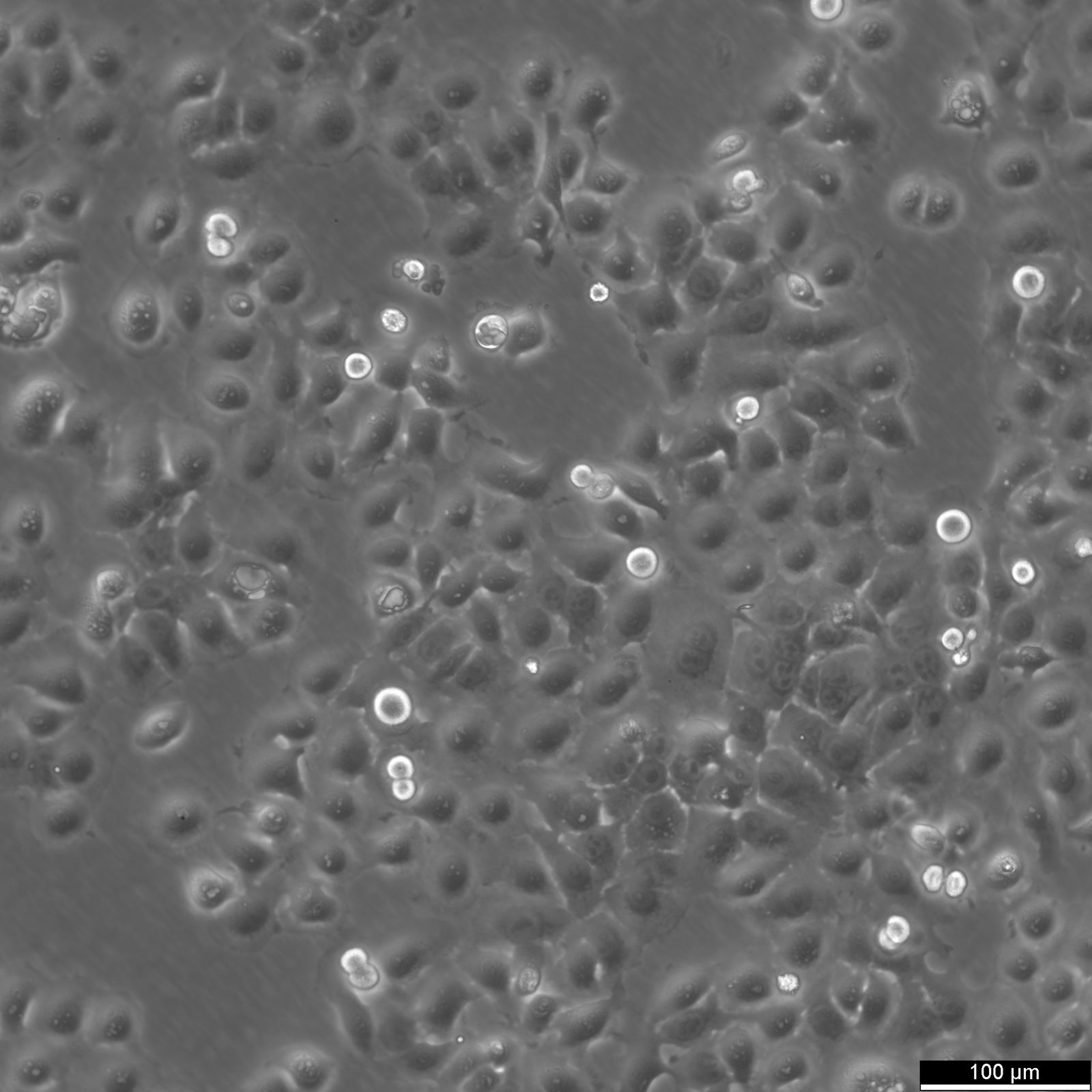 KYSE-150 Cells | Cytion | Biomol.com