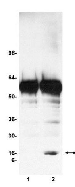 Chromatin Immunoprecipitation (ChIP) Assay Kit, BioAssay, | United ...