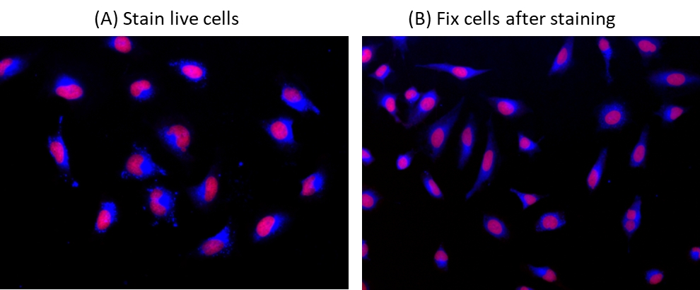 Reticulum Stain Example: Reticulum