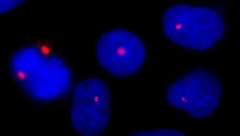 Anti-Pericentrin/Kendrin IHC Antibody, affinity purifie (IHC) | Bethyl ...