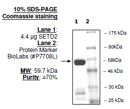 SETD2, Active human recombinant protein, N-terminal GST-tag | BPS ...