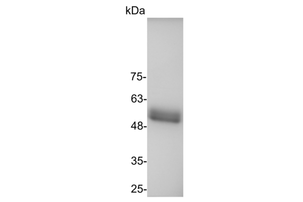 SARS-CoV-2 Spike Protein RBD, His-SUMO Tag, HEK293 | Croyez | Biomol.com