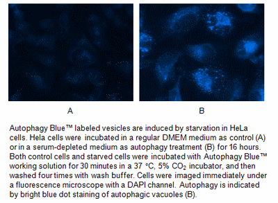 Cell Meter(TM) Autophagy Assay Kit | AAT Bioquest | Biomol.com