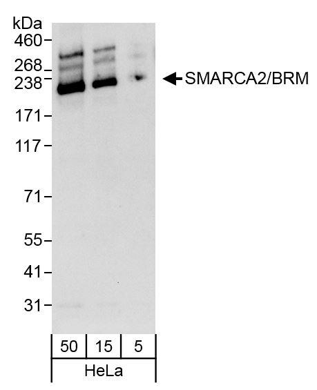 Anti-SMARCA2/BRM | Bethyl Laboratories | Biomol.com