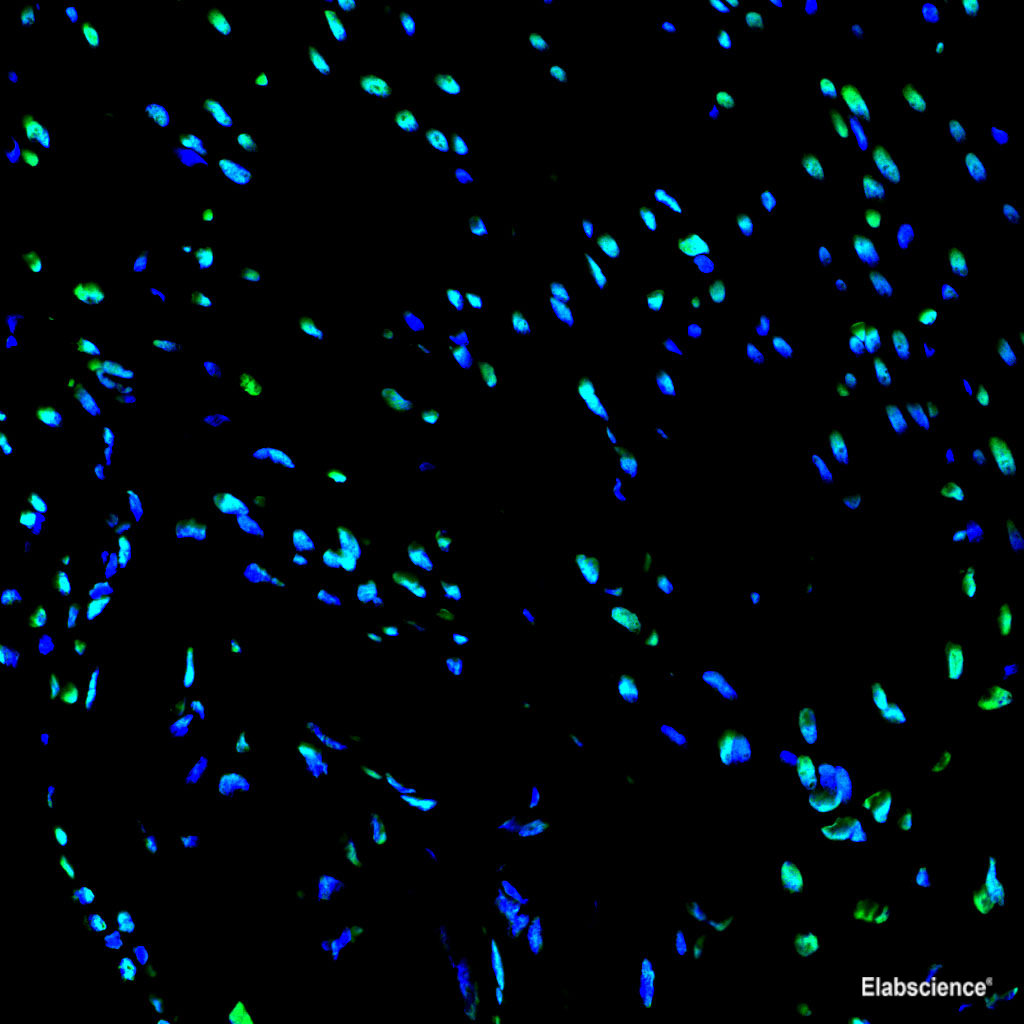 One-step TUNEL in situ Apoptosis Kit (Green, FITC) | Elabscience ...