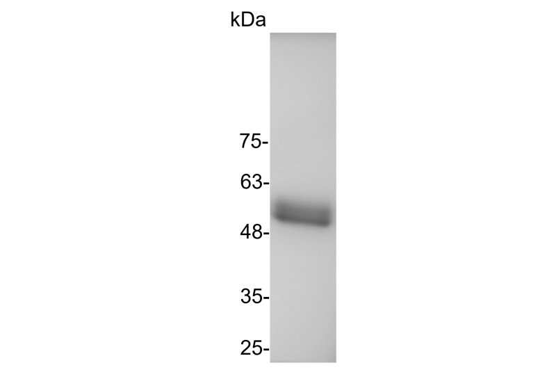 SARS-CoV-2 Spike Protein RBD, His-SUMO Tag, HEK293 | Croyez | Biomol.com