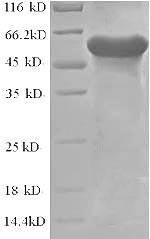 L-lactate dehydrogenase 1 (ldh1), Lactobacillus plantarum, recombinant ...