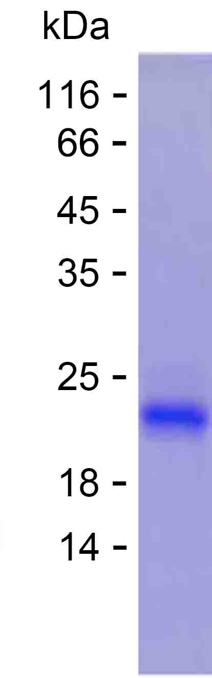 Extracellular Matrix 1 (human), recombinant protein | Absea | Biomol.com