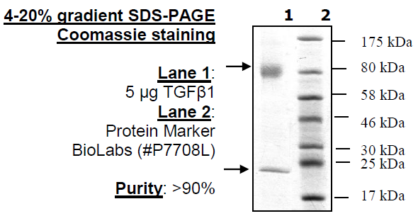 TGFbeta1, latent human recombinant protein, His-tag | BPS Bioscience ...
