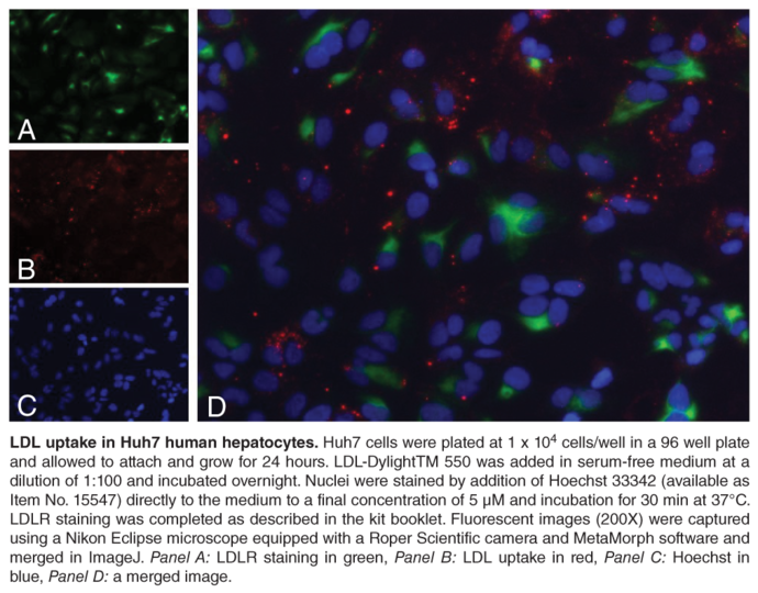 LDL Uptake Cell-Based Assay Kit | Cayman Chemical | Biomol.de