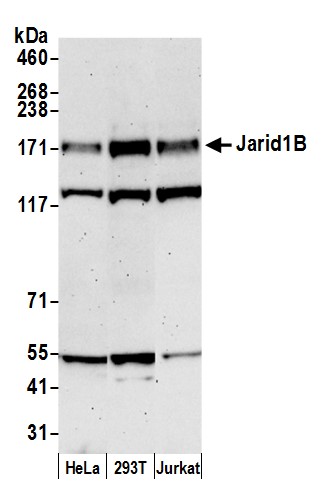 Anti-JARID1B | Bethyl Laboratories | Biomol.de