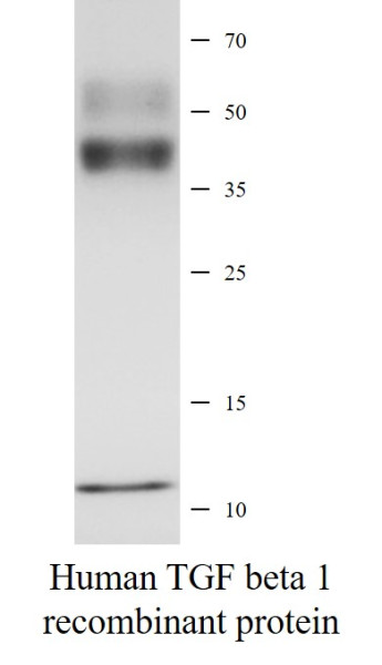 Human TGF beta 1 recombinant protein (Active) (His-tagged, N-ter ...